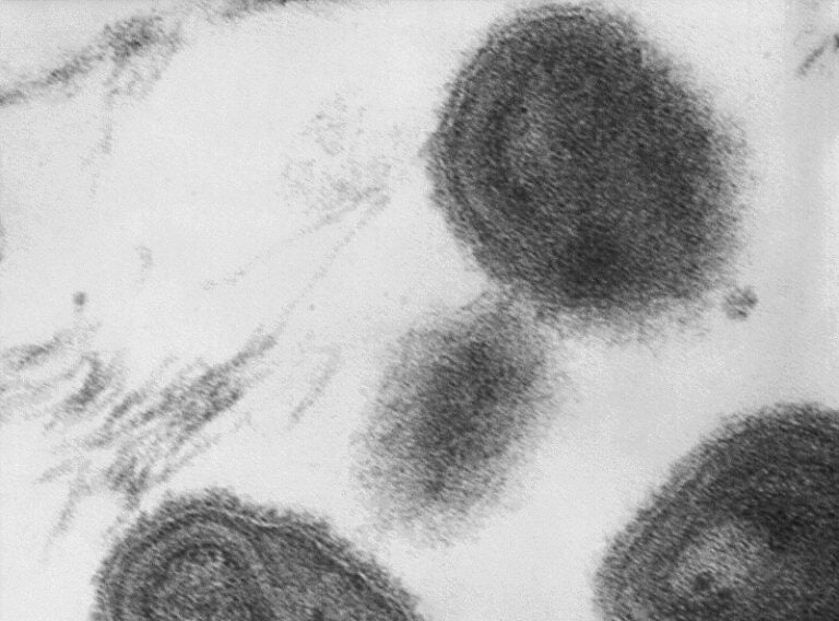 CDND signs contract with Meridian for purchase of Oral TPOXX